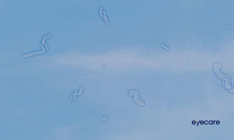 O que são as imagens que lembram moscas volantes? – De olho no futuro ...