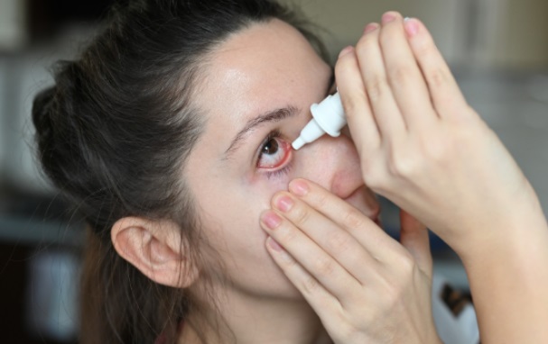 Colírio para conjuntivite: confira + de 10 opções!