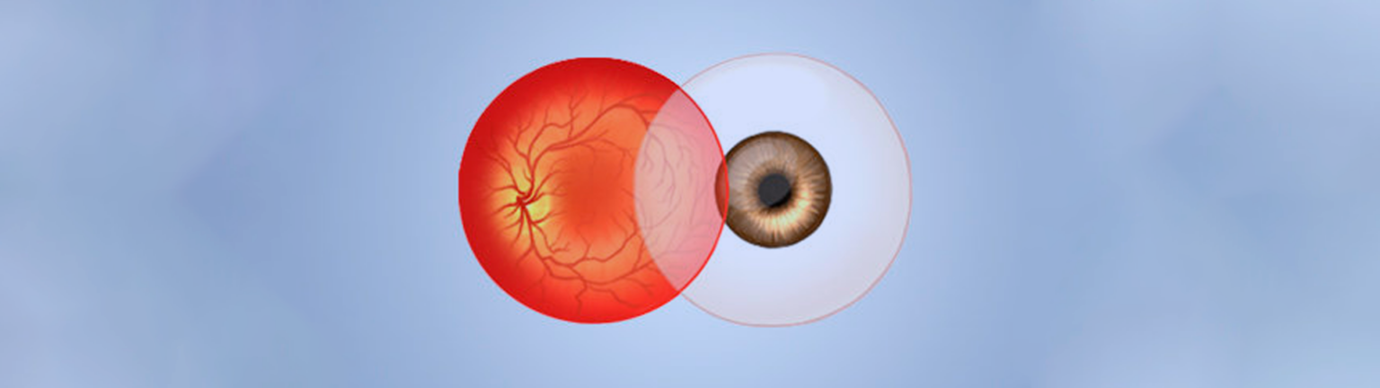 Exame de Fundo de Olho (Fundoscopia): Importância e Procedimento