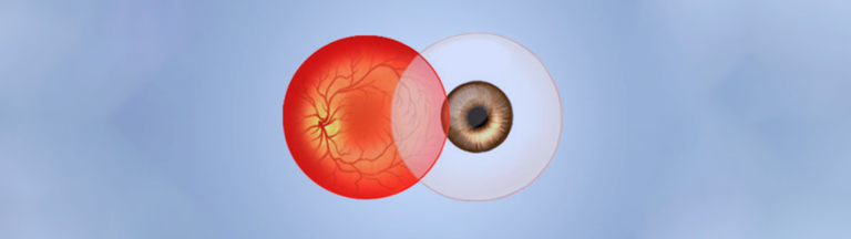 Exame de Fundo de Olho (Fundoscopia): Importância e Procedimento