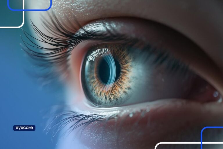 Glaucoma Primário de Ângulo Fechado: Diagnóstico e Tratamento | Eyecare