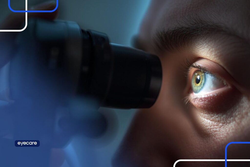 Olhos saltados (proptose ocular): o que significa e quando é sinal de ...