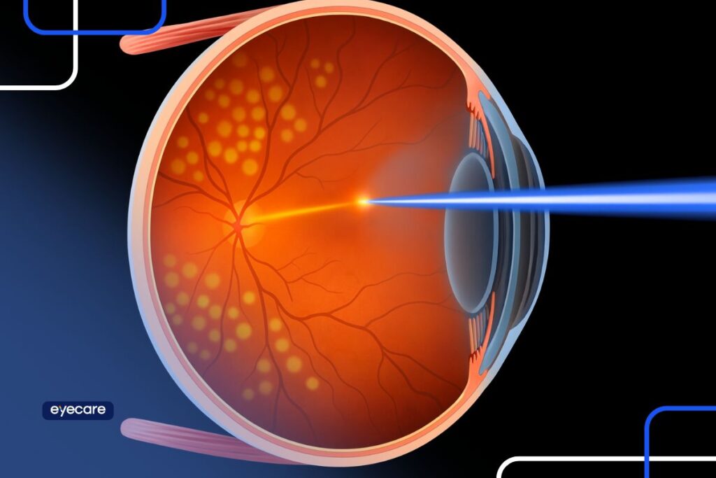 Olhos saltados (proptose ocular): o que significa e quando é sinal de ...